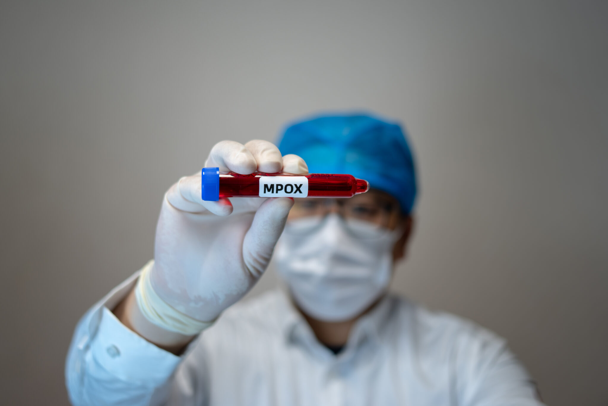 Singapore to take mpox screening measures at sea checkpoints | Port ...